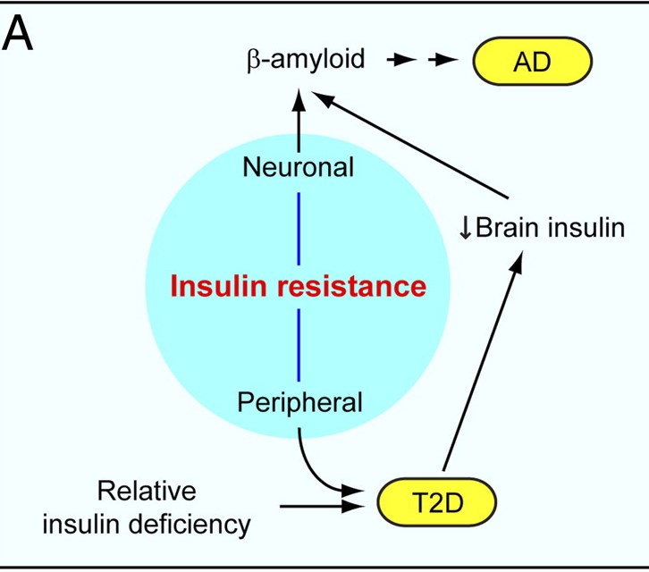 How is Type 2 Diabetes Affecting Your Ability to Learn and Form New ...