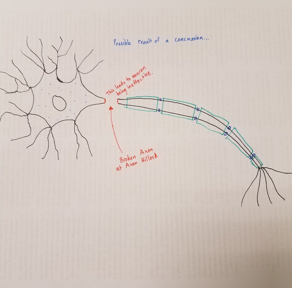 Concussion Background and Visual Imaging – Cobbers on the Brain
