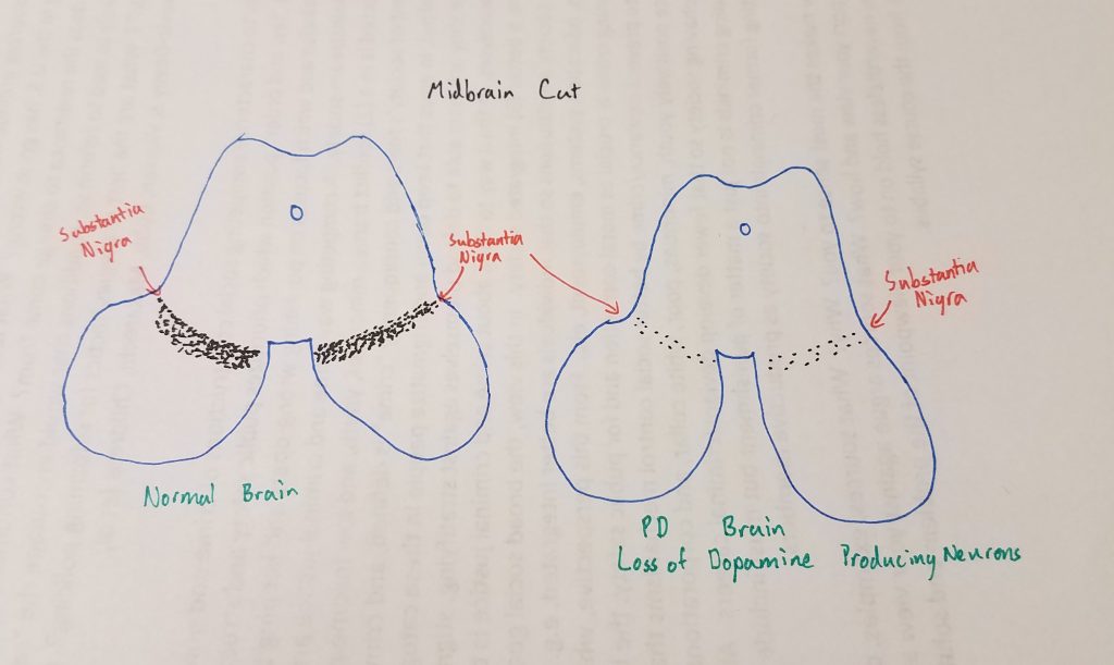 Parkinson s Disease What Is L Dopa And How Does It Act Cobbers On