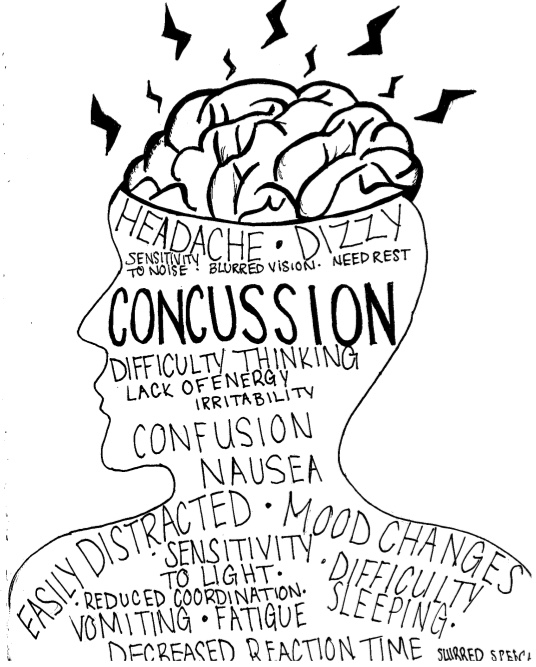 Knocking Out Concussions: What do Concussions Mean for Athletes ...