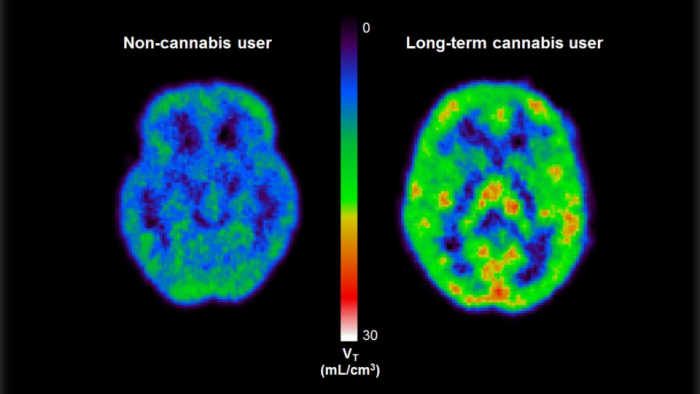 How Does Marijuana Affect the Adolescent Brain? – Cobbers on the Brain