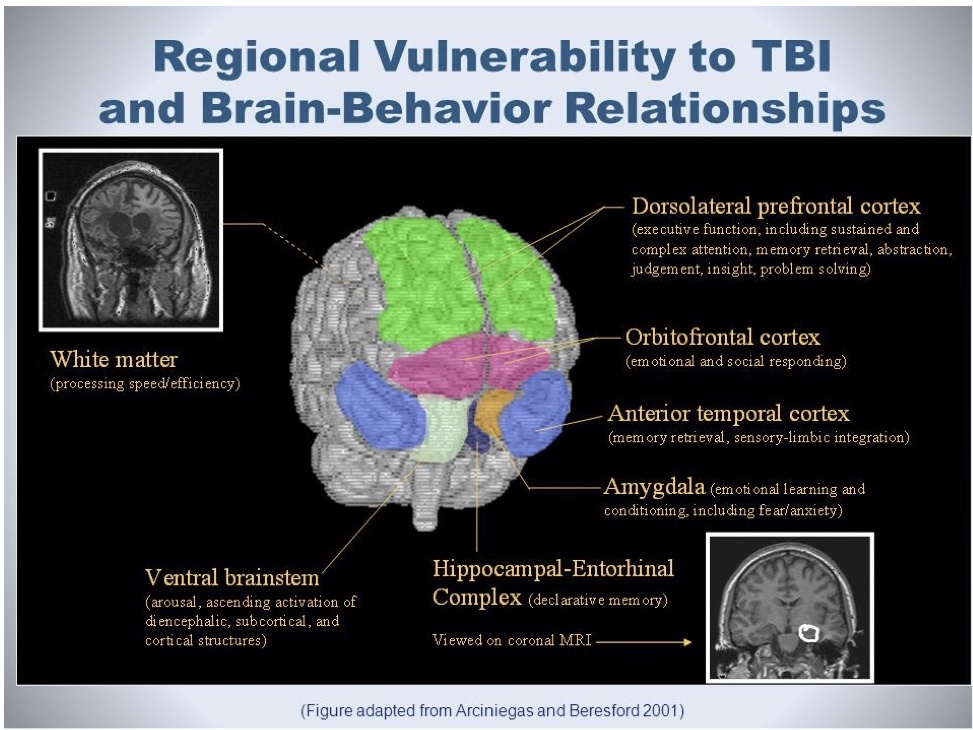 Pathophysiology of Symptoms after a Concussion – Cobbers on the Brain