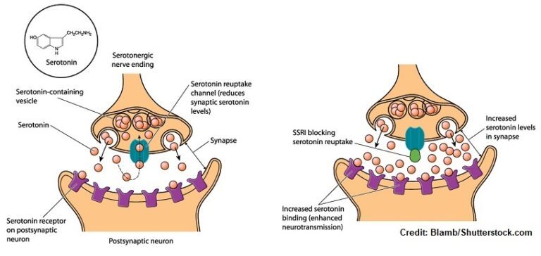 How do anxiety medications work? – Cobbers on the Brain